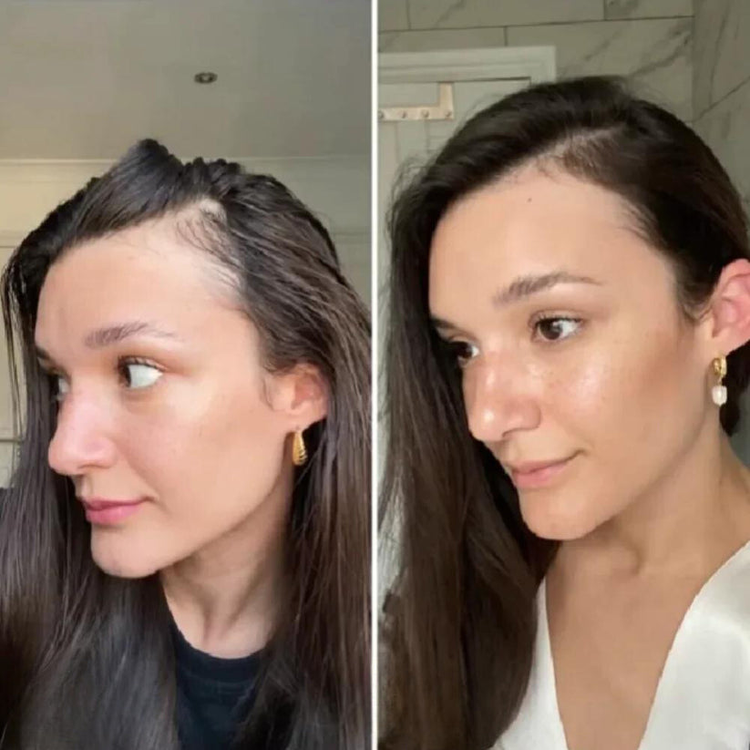 Vogany: Your natural oil for hair growth – VOGANY