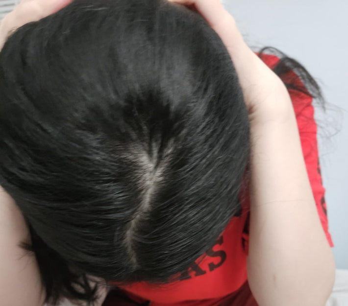 Vogany: Your natural oil for hair growth – VOGANY